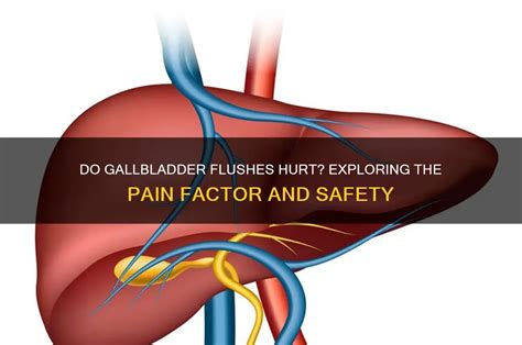 Do Gallbladder Flushes Hurt Exploring The Pain Factor And Safety Medshun