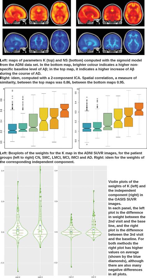 Quantifying ADrelated Brain Amyloid With Linearised Progression Models Modelbased Vs Data
