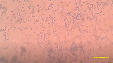 Lactophenol Cotton Blue Lpcb Stain Introduction Principle Test