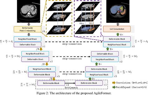 Agileformer Spatially Agile Transformer Unet For Medical Image Segmentation Paper And Code