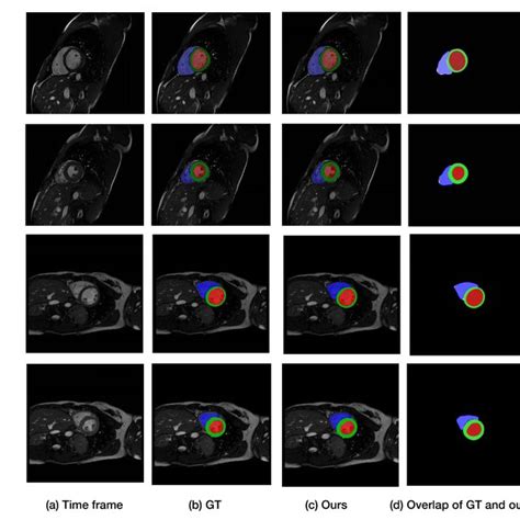 Visual Examples Of Accurate Segmentation From Left To Right Each