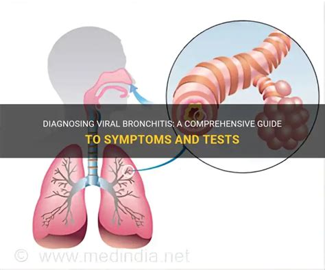 Diagnosing Viral Bronchitis A Comprehensive Guide To Symptoms And Tests Medshun
