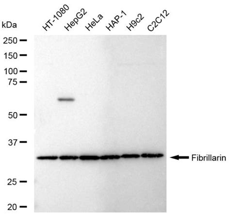 Fibrillarin Recombinant Rabbit Monoclonal Antibody 23gb5735