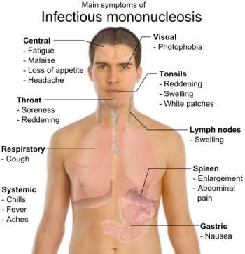 Mononucleosis Symptoms Diagnosis And Treatment Options Fastmed