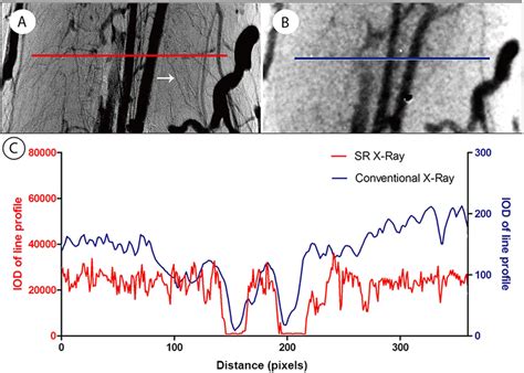 Comparison Of Initial Projected Images Between Synchrotron Radiation Download Scientific