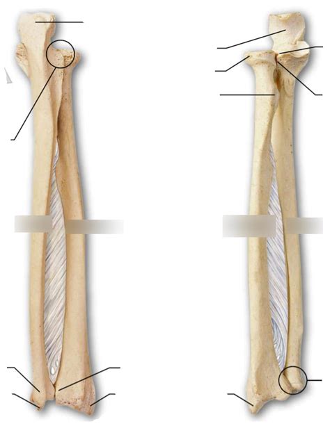 9 Schematic Drawing Of Both The Radius And The Ulna Left