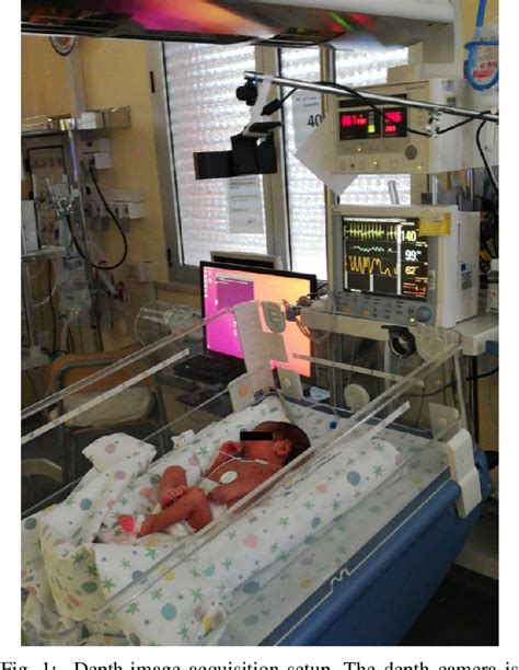 Figure 1 From Preterm Infants Pose Estimation With Spatio Temporal Features Semantic Scholar