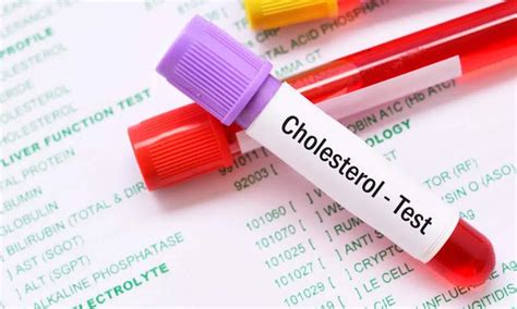 Comment doit être le rapport HDL LDL Vous et Votre Santé