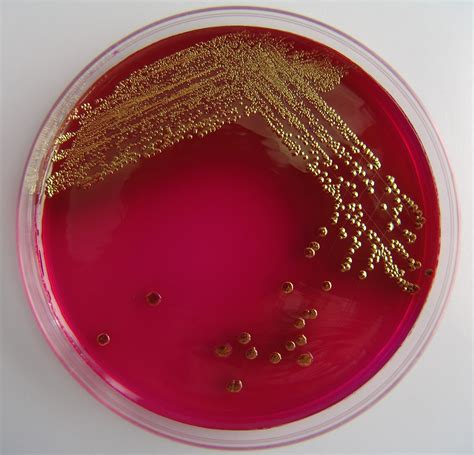 Escherichia Coli Infection E Coli