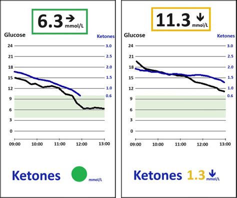 Continuous Ketone Monitoring Exciting Implications For Clinical