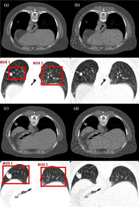 figure 1 from full dose ct database induced reconstruction with