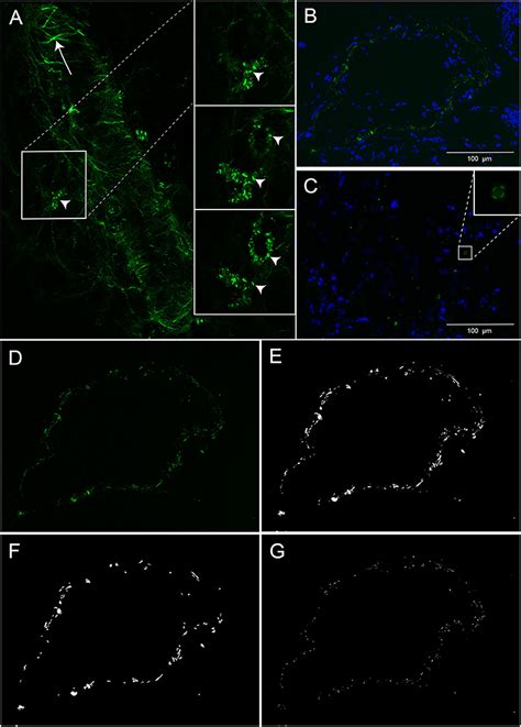 Polarized Cholesterol Crystals