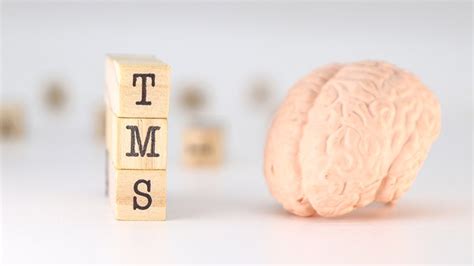 Personalized Rtms Promising For Early Alzheimers Personalized Rtms Promising For Early