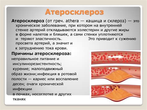 Профилактика атеросклероза - презентация онлайн