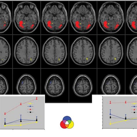 Brain Activation In 18 Selected Axial Slices Throughout The Cortex The