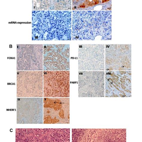 Scheme Of Androgen Receptor Ar Transcriptional Activity A The