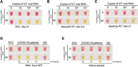 Analytical Sensitivity Of An In House Made Colorimetric Rt Lamp Assay Download Scientific