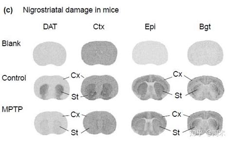每天一支烟，和帕金森说再见？ 知乎