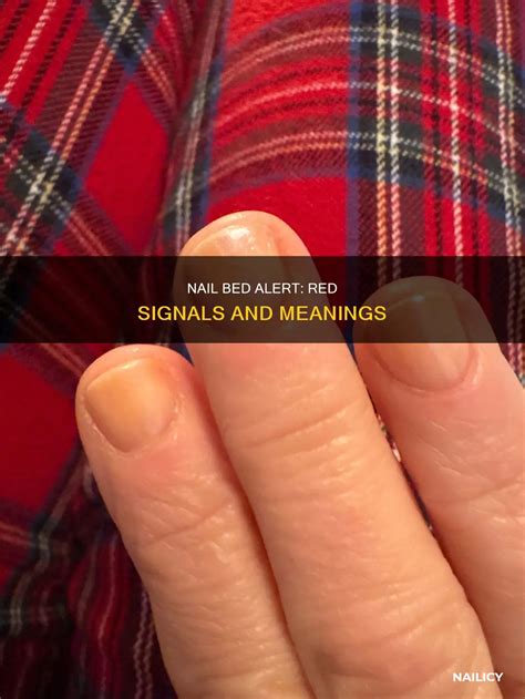 Nail Bed Alert Red Signals And Meanings Nailicy