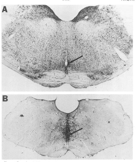 Nucleus Raphe Magnus Semantic Scholar