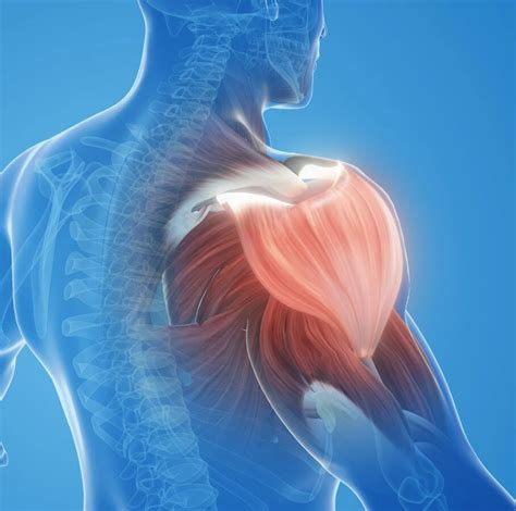 How Varus Valgus Alignment Affects Shoulder Arthroplasty Armando