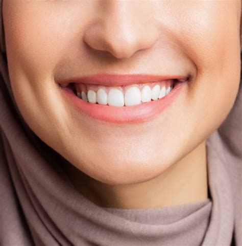 دكتورة دينا المعاري افضل دكتور اسنان في الرياض