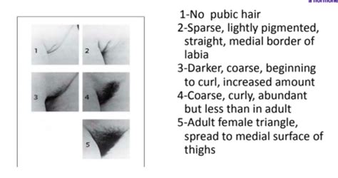 Health Assessment Abdomen Rectum Genitalia Flashcards Quizlet