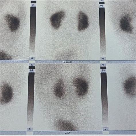 Dimercaptosuccinic Acid Dmsa Scan Download Scientific Diagram
