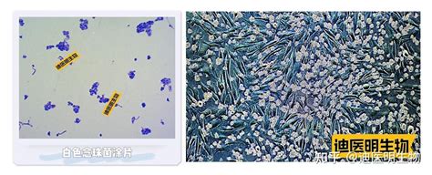 培养的细胞出现真菌污染怎么判断？ 知乎
