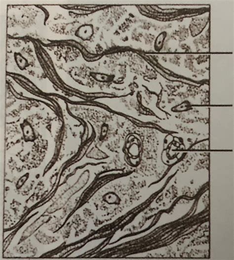 Dense Irregular Connective Tissue Diagram Quizlet