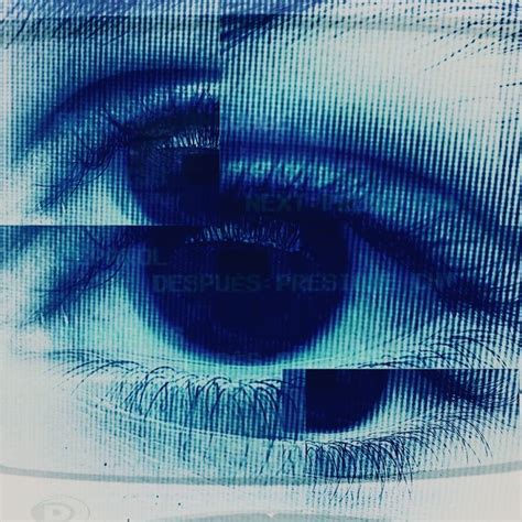 Brain Implants To Restore Sight Like Neuralinks Blindsight Face A Fundamental Problem − More