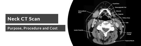 Neck Ct Scan Purpose Procedure And Cost Ganesh Diagnostic