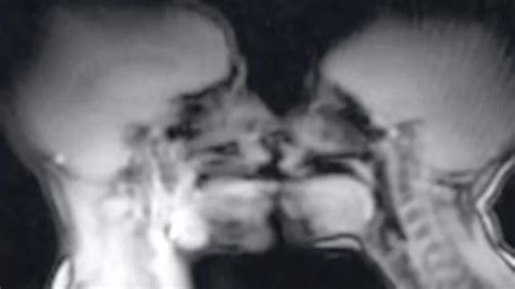रसरच क लए MRI मशन म कपल न बनए थ सबध वयरल हई तसवर MRI scan shows what