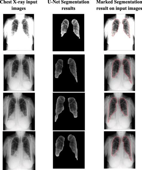sample segmentation results chest x ray images left u net