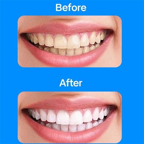 Why Home Treatments Risk Stain Residuals