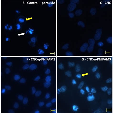 Nuclear Morphology Of A Untreated Cells B Cells Treated With H 2 Download Scientific