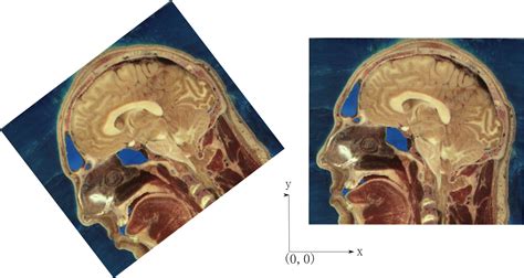 SimpleITK学习一基本概念 wuzeyuan 博客园