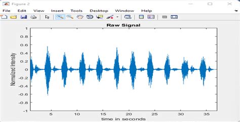 GitHub Ye Sky Detecting Breathing And Snoring With Matlab