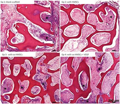 Tissue After 2 Weeks Granulation Tissue Was Observed In All Groups