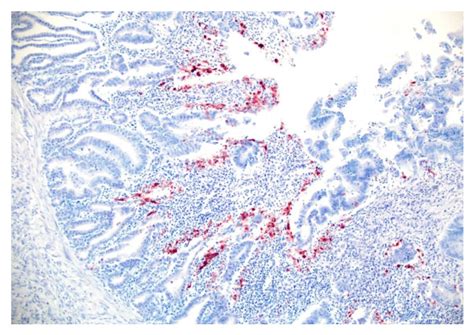 Diagnostic Findings Of Transmissible Viral Proventriculitis Associated
