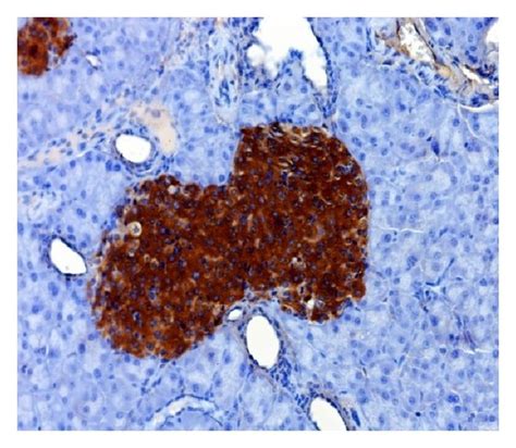 Immunolabeling Of The Native Pancreas ×200 A Positive Control