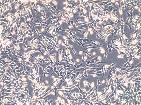 贴壁细胞图片 壁细胞图片 细胞图片手绘图 大山谷图库