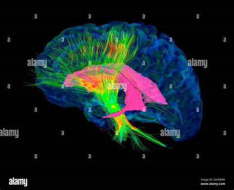 Brain Fibres 3d Diffusion Tensor Imaging Dti Magnetic Resonance
