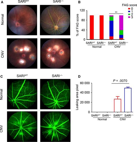 Fundus And Fluorescence Imaging Of Laser‐induced Choroidal Download Scientific Diagram