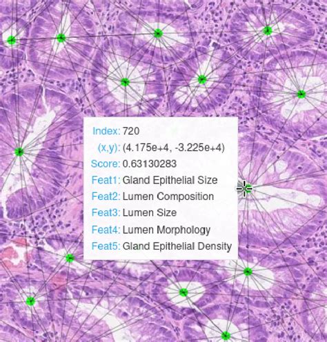 Tiaviz A Browser Based Visualization Tool For Computational Pathology Models