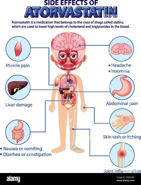 Human Anatomy Diagram Cartoon Style Of Atorvastatin Side Effects Illustration Stock Vector Image