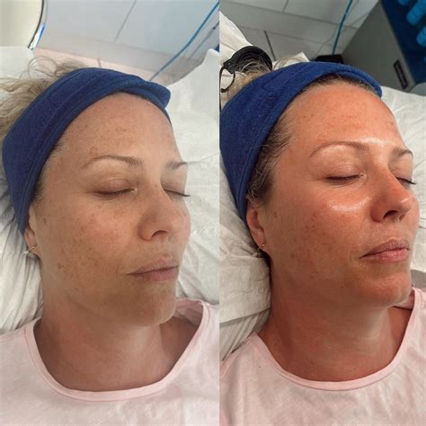 The Melrose Glow Like Never Before With The One And Only Official