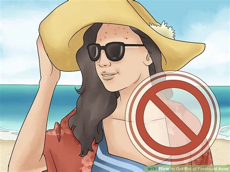 4 Ways To Get Rid Of Forehead Acne WikiHow