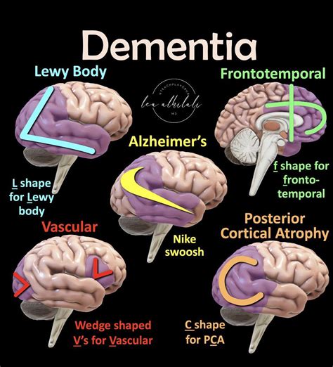Дотрын Эмчийн 📌 Деменце Деменце латинаар Dementia гэдэг нь танин мэдэхүй ой тогтоолт