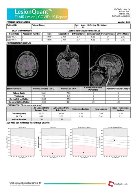 Brain Volumetrics Reveal Possible Covid 19 Neurological Manifestations